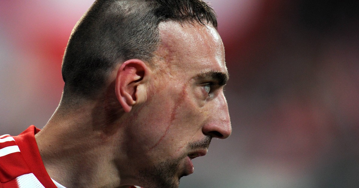 Franck Ribéry: Icon League, Frau und Vermögen – das wurde aus dem ...